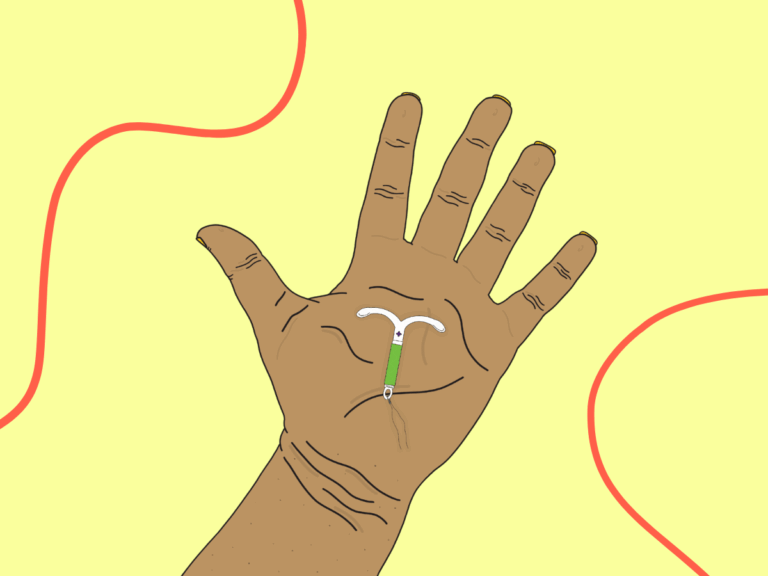 Emergency Contraception: The IUD
